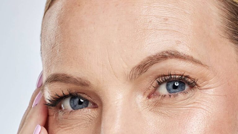 Chemical Peels for Wrinkles: Guide + 5 Must-Try Products | MyPeeling.com